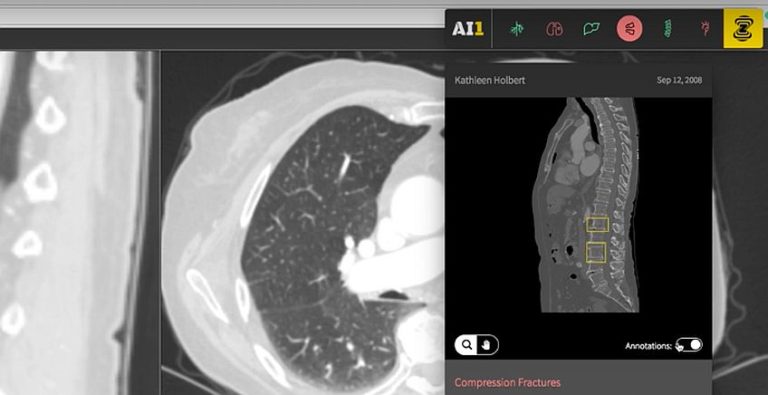 Zebra Medical Raised $30M for Automated AI Based Radiology - Israel ...